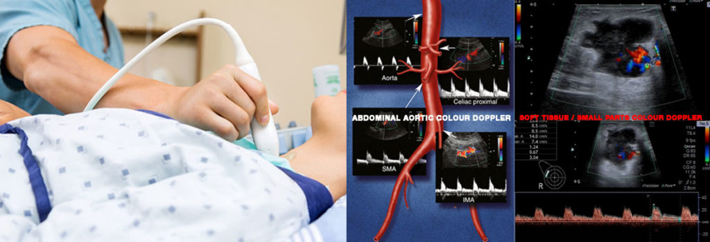 Vascular Imaging or Colour Doppler- Sonography Center in Dhantoli